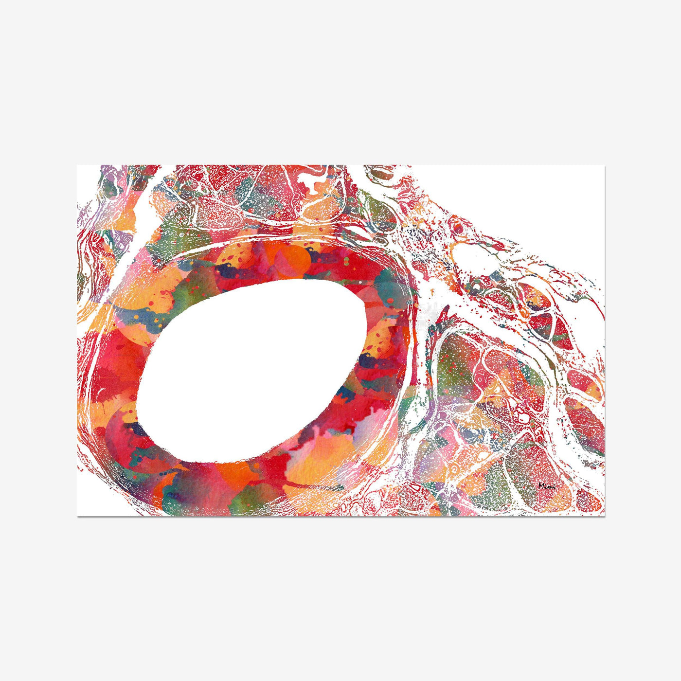 Aorta Cross Section Print Histology Anatomy Print – MimiPrints Anatomy ...